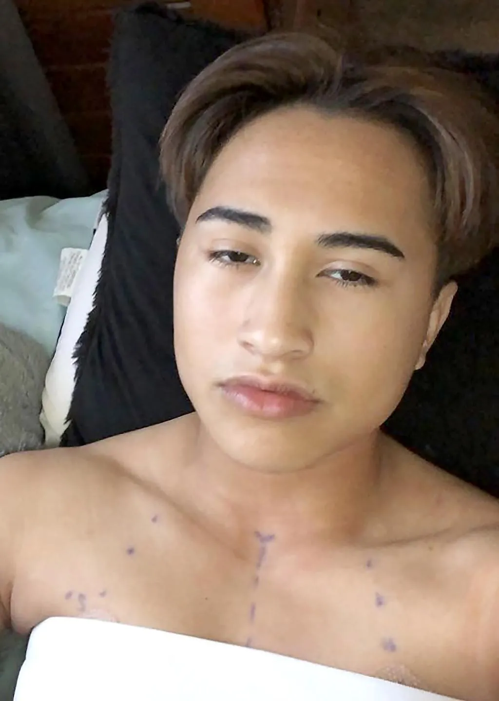 [Interview] “Detransitioner”: “After The Surgery, I Was Not A Boy, Just ...